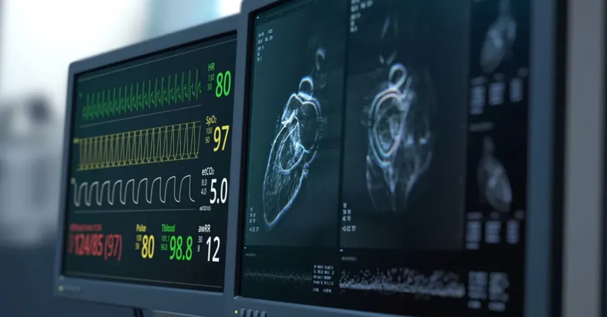 Reduced cardiac function in a minority of COVID-19 patients - Oslo ...