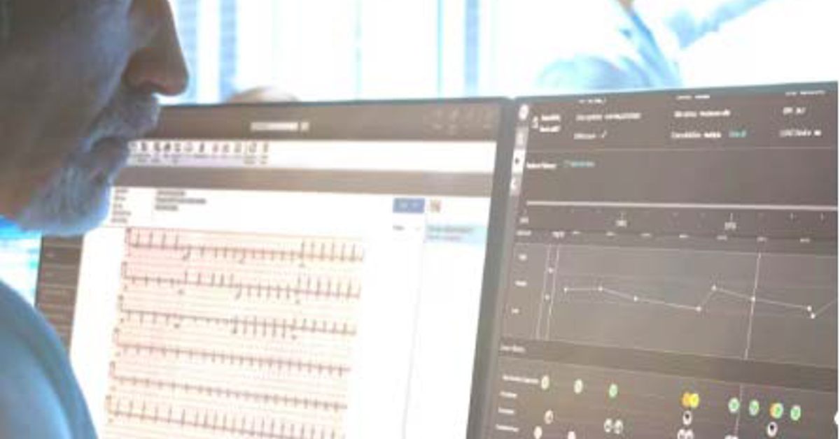 CardioVisio for Atrial Fibrillation - Oslo universitetssykehus HF